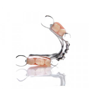 Parcijalna proteza za zube - praktično rješenje kod gubitka više zuba