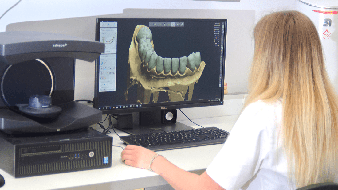 Cirkon-keramika - najsuvremeniji materijal za izradu zubnih krunica